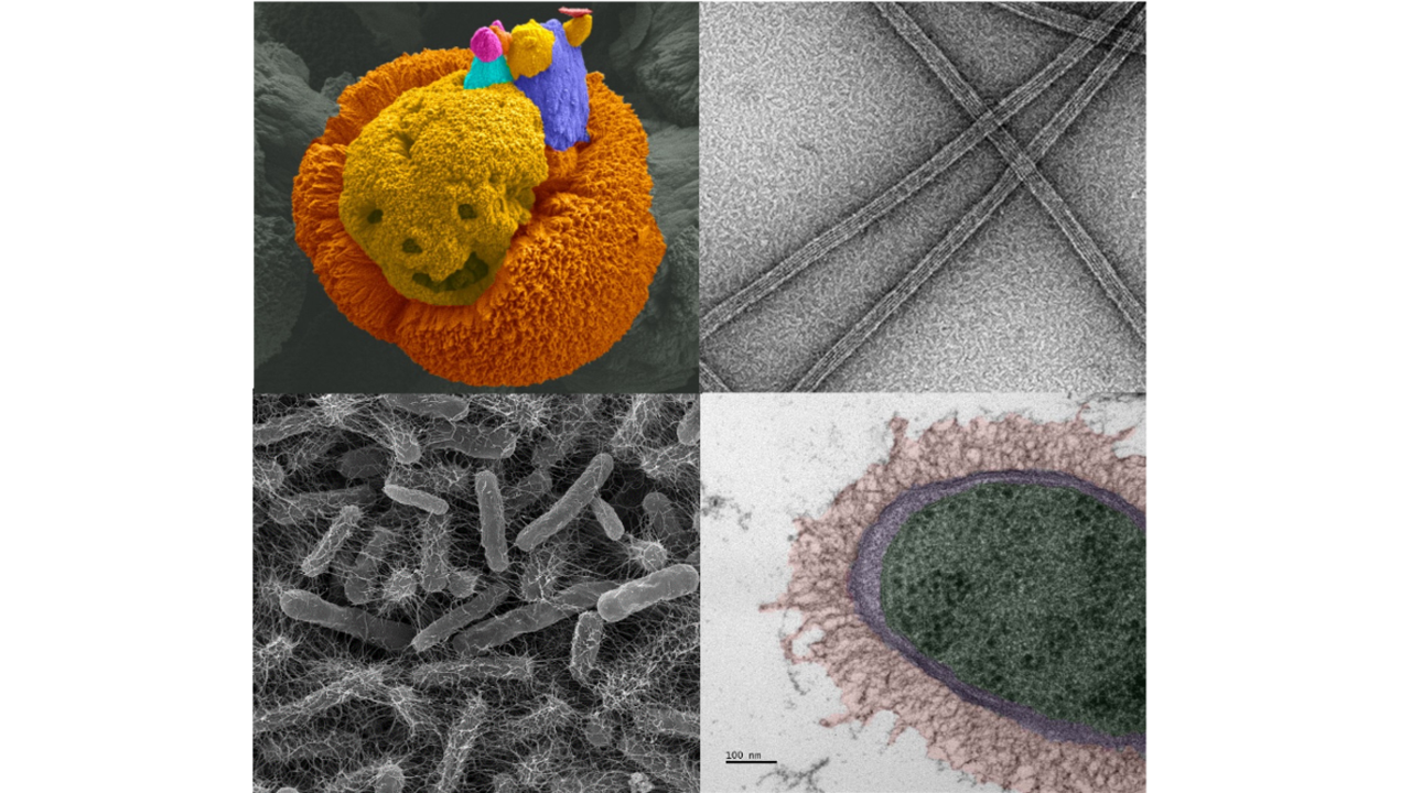 Basic Course in Scanning and Transmission Electron Microscopy (SEM/TEM ...