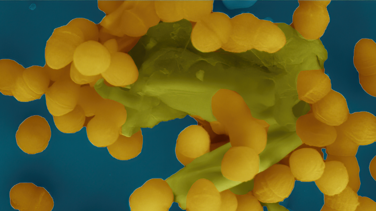 Degradation of cell wall key in the spread of resistance