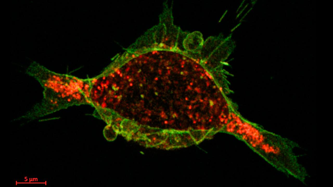 Calcium-sensitive switch boosts the efficacy of cancer drugs