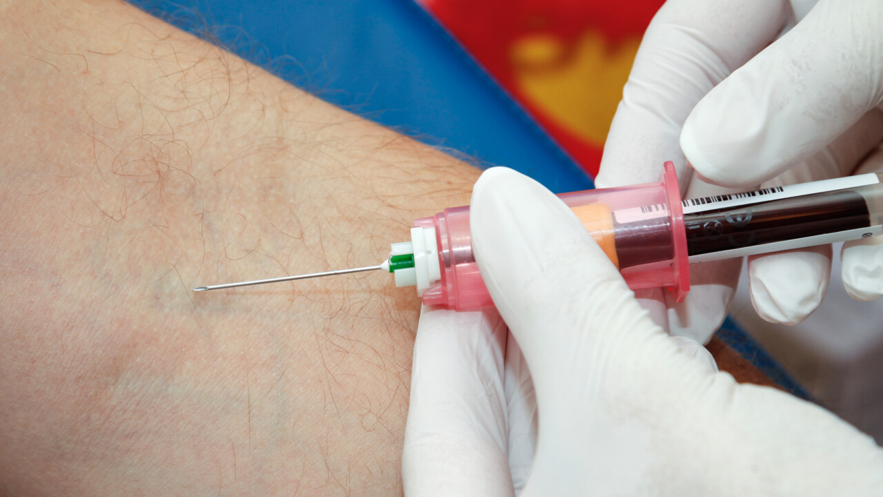 Simpler and reliable ALS diagnosis with blood tests