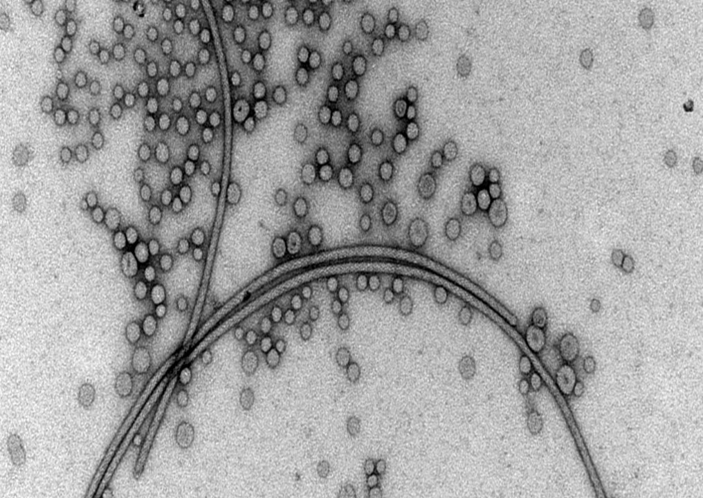 Basic Course in SEM and TEM (1 ECTS) 19-21 February 2019