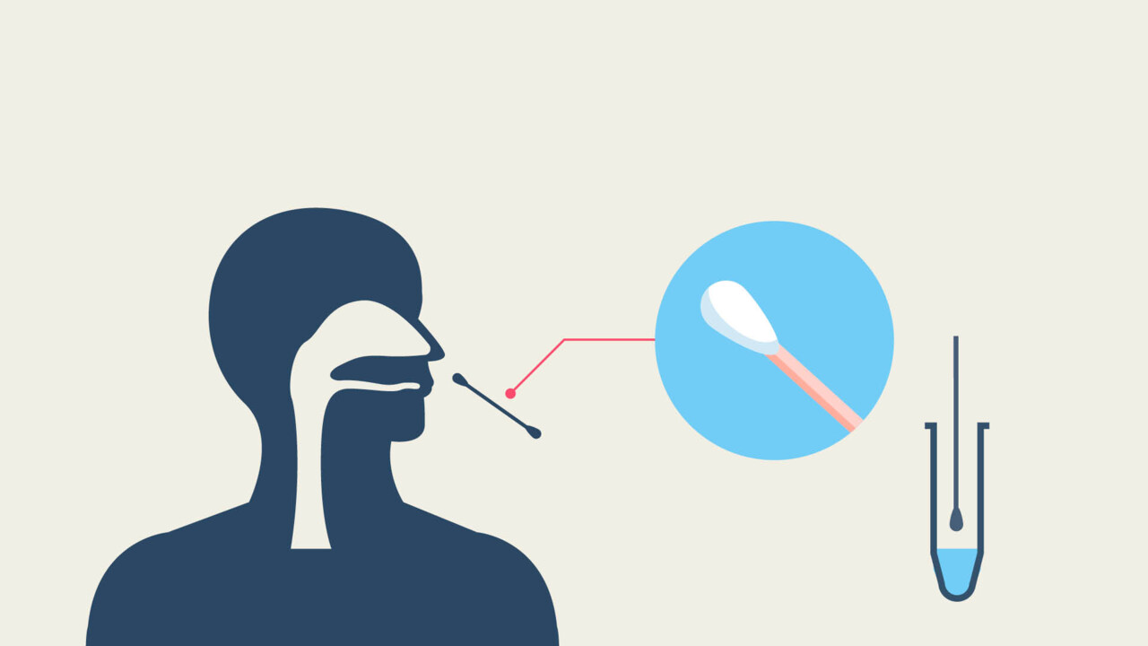 Möjlighet till provtagning för covid-19 på Campus Umeå